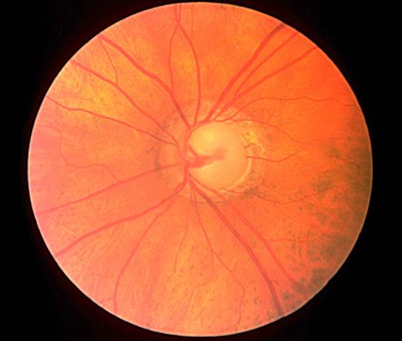 © Augenklinik, Inselspital, Universitätsspital Bern