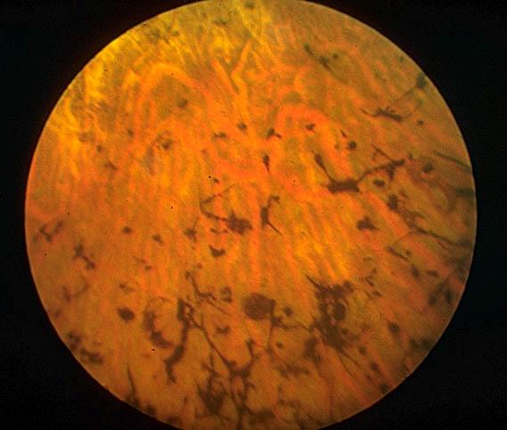 © Augenklinik, Inselspital, Universitätsspital Bern