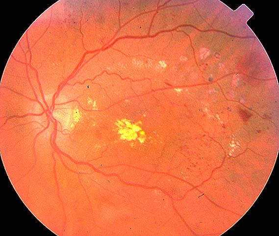 © Augenklinik, Inselspital, Universitätsspital Bern